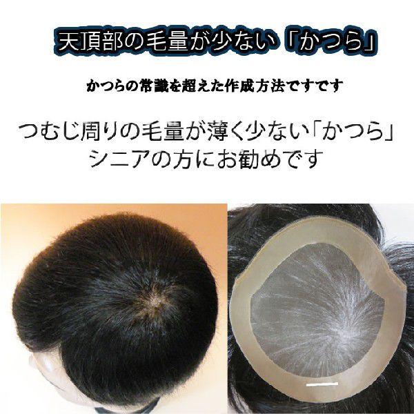 天頂部つむじ周りの毛量が薄く少ないかつら、シニアの方にお勧めです●火・水・木曜日定休日のため、発送は休み明けになります。