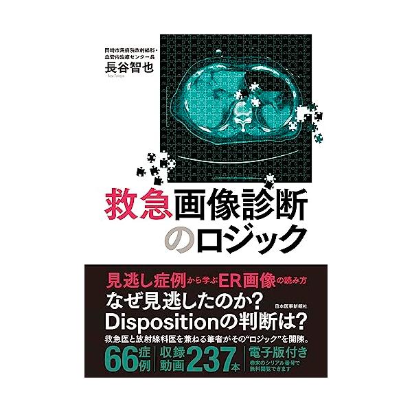 なぜ見逃したのか？・・・レジデント必読！ 見逃し症例から学ぶER画像の読み方 研修医の勉強会でみんながよく見逃す症例や、ERで誤診された症例などについて、どうやったら診断できたのか、あるいは診断できなかったのならdispositionはどう...