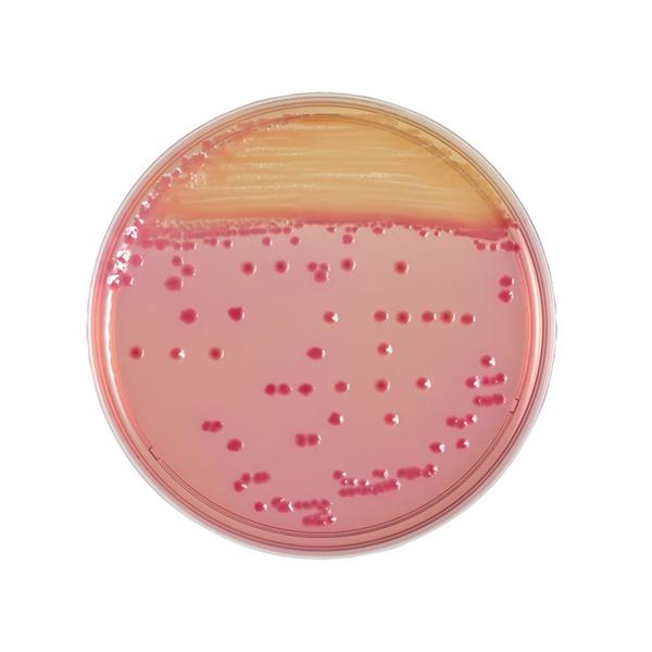 ●<商品詳細参考ページ>外部リンク：https://axel.as-1.co.jp/asone/d/63-6527-62/●事業者向け商品です。●生培地●用途：エルシニア用●入数：20枚入