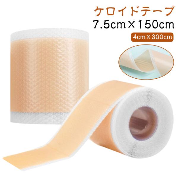 4cm×150cm 4cm×300cm 7.5cm×150cm