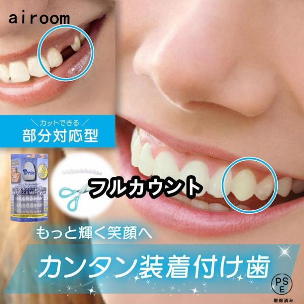 すきっ歯、黄色い歯、欠けた歯も手軽にカバー。素敵な笑顔に!!