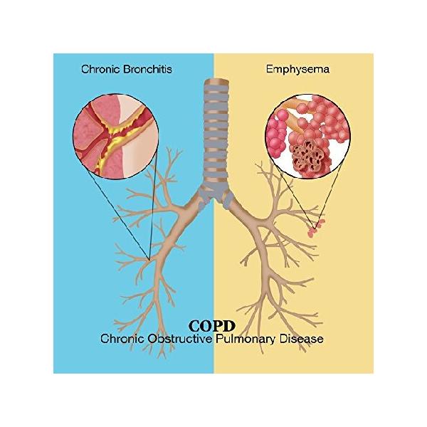 ■こちらの商品は海外倉庫からの取り寄せとなるため、お届けまでに5〜14営業日程度のお時間をいただいております。■ご注文後の取り寄せ状況はメールにて随時お知らせ致します。■稀に輸送による外箱のダメージや、税関検査による開封跡がある場合がござい...