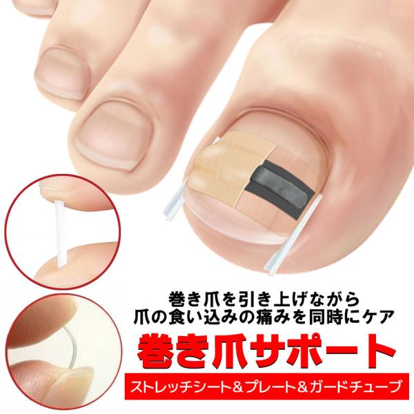 ◆注意事項<br>・本品は医療用ではありません。<br>・使用時間、使用方法を必ずお守りください。<br>・使用目的以外にはご使用しないでください。<br>・巻き爪の程度がひどい場合には使用で...