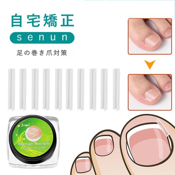 【セット内容】巻き爪パッド×50枚   爪垢取り×1個【自分でできる】加工不要の巻き爪・陥入爪の矯正器具ですぐに使えます。痛くない！自分でできる！【ご注意】 ※本品は医療用ではありません。※巻き爪の程度がひどい場合には使用できません。※器具...