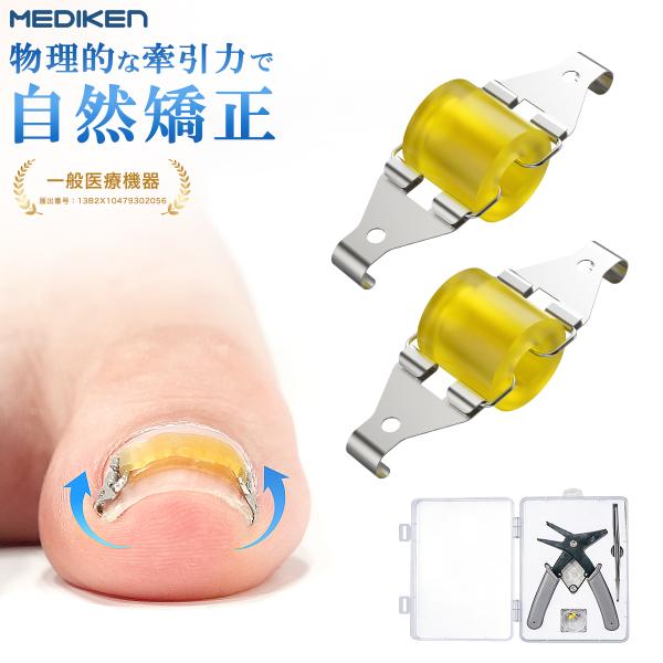 商品名：mediken (メディケン)  独自の超弾性設計 巻き爪矯正クリップ 一般医療機器 巻き爪矯正器具 S/Mサイズ 2枚セット 巻爪 まき爪 矯正器具 足用 ノーマルセット フットケア 人気 足指 人差し指対応 高齢者対応 凸爪 装...
