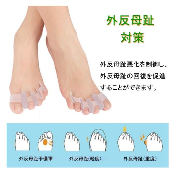商品の説明：【該当】外反母趾、内反小趾、指、寝指、ハンマー指、指先が曲がっている（曲がっている）など、足の指にお困りの方!つま先外反母趾サポーターは、人間工学に基づいて、つま先の曲がりを改善し、足の裏のバランスを緩和し、痛みや疲労を軽減しま...