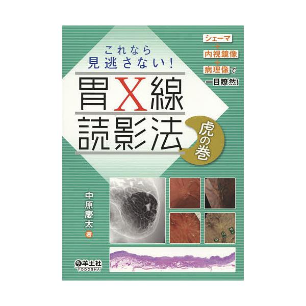 ※商品画像はイメージや仮デザインが含まれている場合があります。帯の有無など実際と異なる場合があります。著:中原慶太出版社:羊土社発売日:2015年11月キーワード:これなら見逃さない！胃X線読影法虎の巻シェーマ＋内視鏡像＋病理像で一目瞭然！...