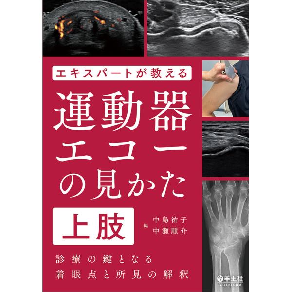 編:中島祐子　編:中瀬順介出版社:羊土社発売日:2022年08月キーワード:エキスパートが教える運動器エコーの見かた診療の鍵となる着眼点と所見の解釈上肢中島祐子中瀬順介 えきすぱーとがおしえるうんどうきえこーのみかた エキスパートガオシエル...