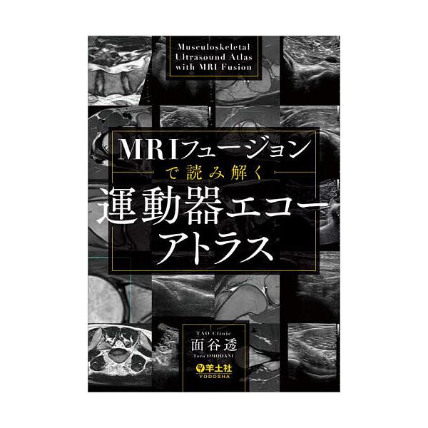 ※商品画像はイメージや仮デザインが含まれている場合があります。帯の有無など実際と異なる場合があります。著:面谷透出版社:羊土社発売日:2026年06月キーワード:MRIフュージョンで読み解く運動器エコーアトラス面谷透 えむあーるあいふゆーじ...