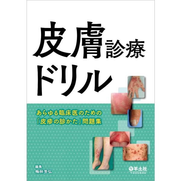 ※商品画像はイメージや仮デザインが含まれている場合があります。帯の有無など実際と異なる場合があります。編集:梅林芳弘出版社:羊土社発売日:2021年10月キーワード:皮膚診療ドリルあらゆる臨床医のための「皮疹の診かた」問題集梅林芳弘 ひふし...