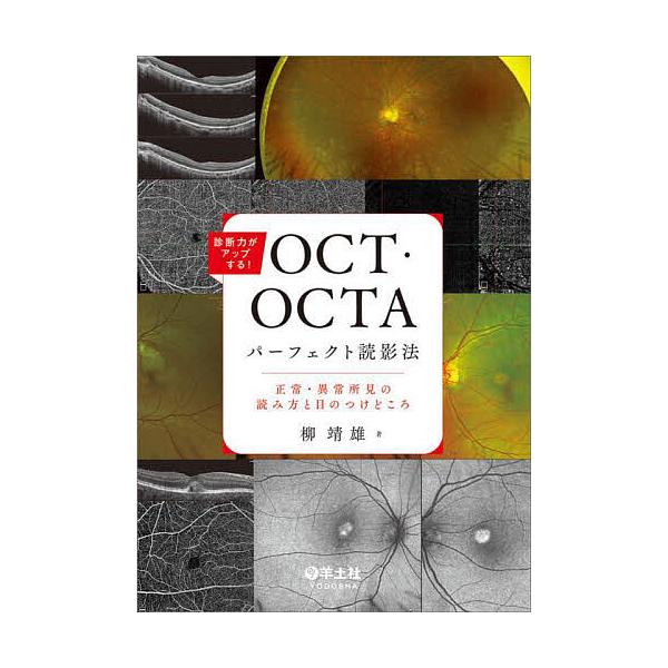 著:柳靖雄出版社:羊土社発売日:2023年10月キーワード:診断力がアップする！OCT・OCTAパーフェクト読影法正常・異常所見の読み方と目のつけどころ柳靖雄 しんだんりよくがあつぷするおーしーていーおーしーて シンダンリヨクガアツプスルオ...
