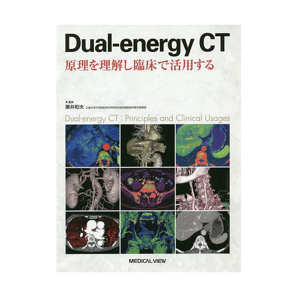 編集:粟井和夫出版社:メジカルビュー社発売日:2019年09月キーワード:Dual‐energyCT原理を理解し臨床で活用する粟井和夫 でゆあるえなじーしーていーＤＵＡＬＥＮＥＲＧＹＣＴ デユアルエナジーシーテイーＤＵＡＬＥＮＥＲＧＹＣＴ ...