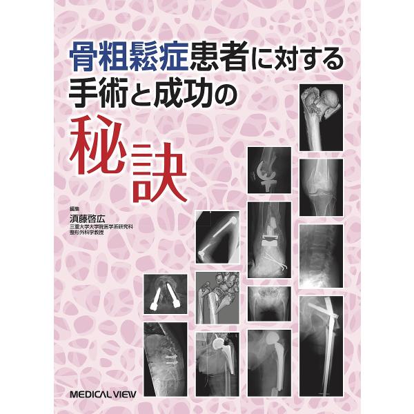 編集:【ス】藤啓広出版社:メジカルビュー社発売日:2019年10月キーワード:骨粗鬆症患者に対する手術と成功の秘訣【ス】藤啓広 こつそしようしようかんじやにたいするしゆじゆつとせ コツソシヨウシヨウカンジヤニタイスルシユジユツトセ すどう ...