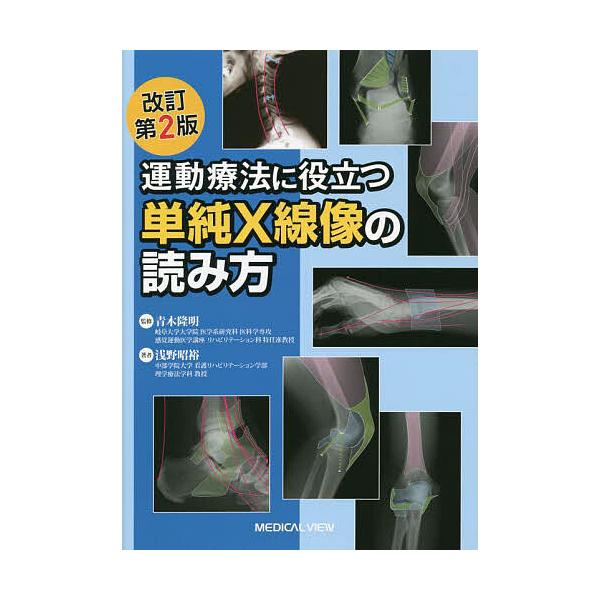 ※商品画像はイメージや仮デザインが含まれている場合があります。帯の有無など実際と異なる場合があります。著:浅野昭裕　監修:青木隆明出版社:メジカルビュー社発売日:2022年11月キーワード:運動療法に役立つ単純X線像の読み方浅野昭裕青木隆明...
