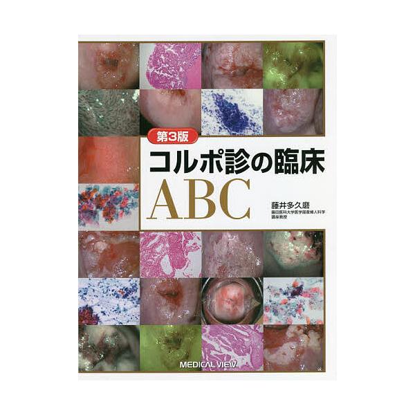 ※商品画像はイメージや仮デザインが含まれている場合があります。帯の有無など実際と異なる場合があります。著:藤井多久磨出版社:メジカルビュー社発売日:2022年03月キーワード:コルポ診の臨床ABC藤井多久磨 こるぽしんのりんしようえーびーし...