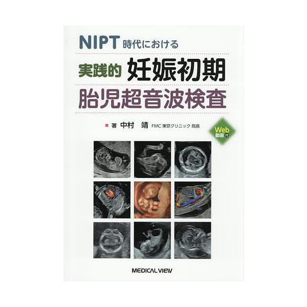 ※商品画像はイメージや仮デザインが含まれている場合があります。帯の有無など実際と異なる場合があります。著:中村靖出版社:メジカルビュー社発売日:2025年07月キーワード:実践的妊娠初期胎児超音波検査NIPT時代における中村靖 じつせんてき...