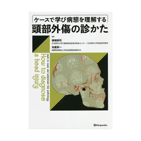 ※商品画像はイメージや仮デザインが含まれている場合があります。帯の有無など実際と異なる場合があります。編集:横堀將司　編集:末廣栄一　ほか執筆:秋元秀昭出版社:金芳堂発売日:2021年11月キーワード:ケースで学び病態を理解する頭部外傷の診...