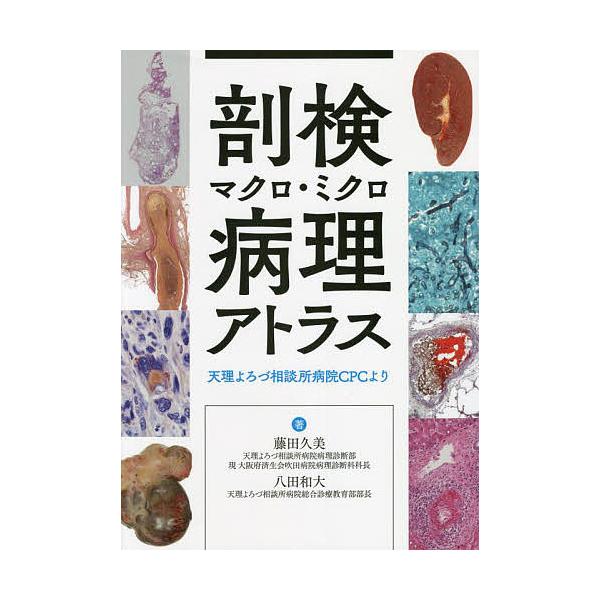 著:藤田久美　著:八田和大出版社:金芳堂発売日:2022年03月キーワード:剖検マクロ・ミクロ病理アトラス天理よろづ相談所病院CPCより藤田久美八田和大 ぼうけんまくろみくろびようりあとらすてんりよろず ボウケンマクロミクロビヨウリアトラス...