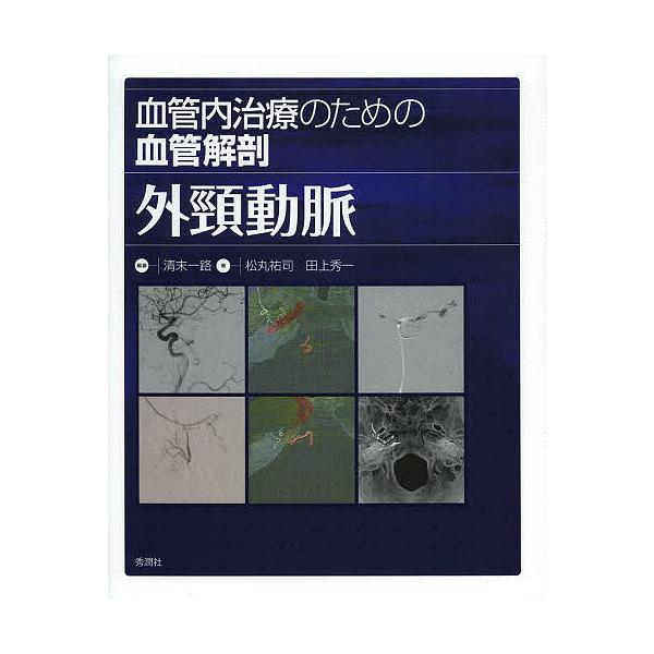 ※商品画像はイメージや仮デザインが含まれている場合があります。帯の有無など実際と異なる場合があります。編著:清末一路　著:松丸祐司　著:田上秀一出版社:学研メディカル秀潤社発売日:2013年09月キーワード:血管内治療のための血管解剖外頸動...