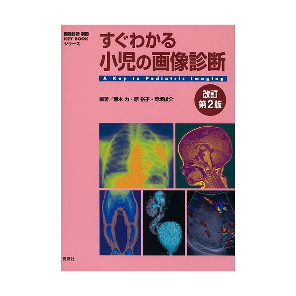 編著:荒木力　編著:原裕子　編著:野坂俊介出版社:学研メディカル秀潤社発売日:2017年04月シリーズ名等:画像診断別冊KEY BOOKシリーズキーワード:すぐわかる小児の画像診断荒木力原裕子野坂俊介 すぐわかるしようにのがぞうしんだんがぞ...