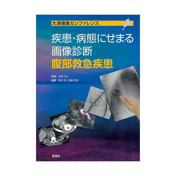 監修:小林久人　編著:松木充　編著:市場文功出版社:学研メディカル秀潤社発売日:2016年09月キーワード:疾患・病態にせまる画像診断腹部救急疾患大津画像カンファレンス小林久人松木充市場文功 しつかんびようたいにせまるがぞうしんだんふくぶ ...