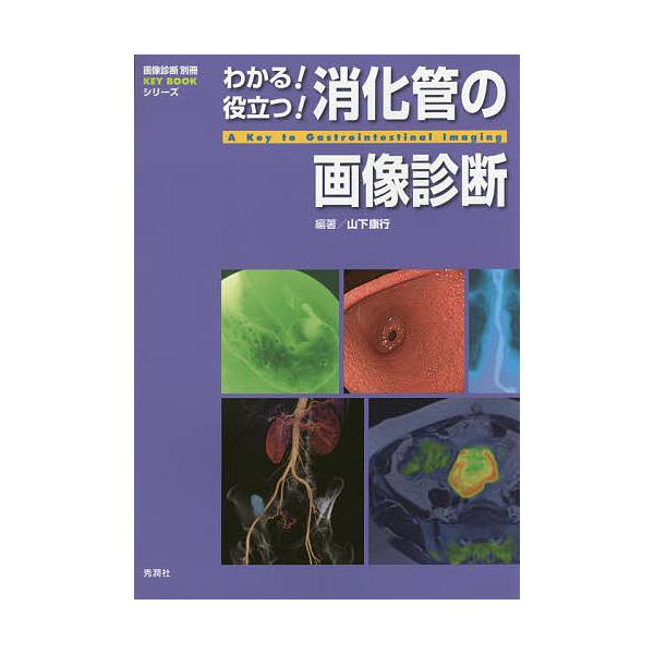 編著:山下康行出版社:学研メディカル秀潤社発売日:2015年04月シリーズ名等:画像診断別冊KEY BOOKシリーズキーワード:わかる！役立つ！消化管の画像診断山下康行 わかるやくだつしようかかんのがぞうしんだんがぞう ワカルヤクダツシヨウ...