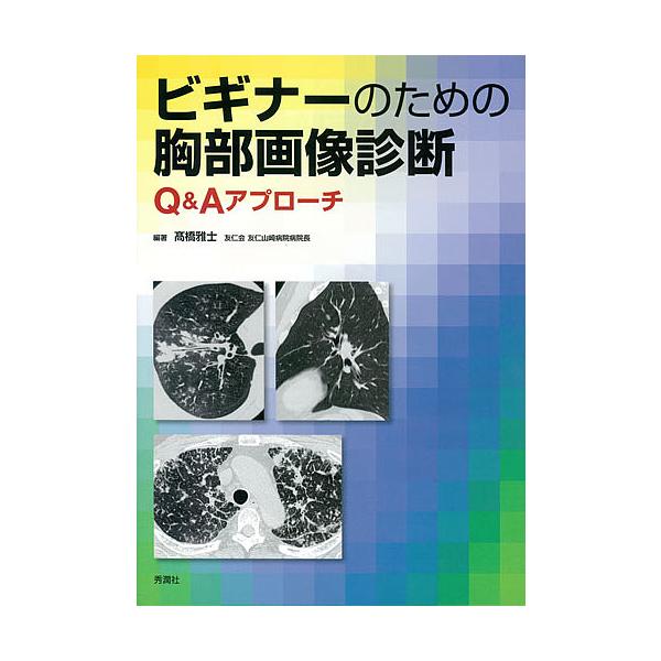 編著:高橋雅士出版社:学研メディカル秀潤社発売日:2016年04月キーワード:ビギナーのための胸部画像診断Q＆Aアプローチ高橋雅士 びぎなーのためのきようぶがぞうしんだん ビギナーノタメノキヨウブガゾウシンダン たかはし まさし タカハシ マサシ