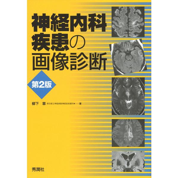 ※商品画像はイメージや仮デザインが含まれている場合があります。帯の有無など実際と異なる場合があります。著:柳下章出版社:学研メディカル秀潤社発売日:2019年04月キーワード:神経内科疾患の画像診断柳下章 しんけいないかしつかんのがぞうしん...