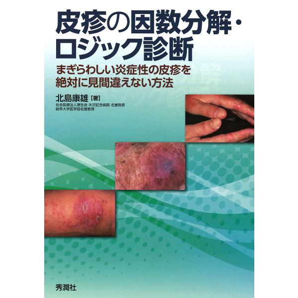 ※商品画像はイメージや仮デザインが含まれている場合があります。帯の有無など実際と異なる場合があります。著:北島康雄出版社:学研メディカル秀潤社発売日:2018年11月キーワード:皮疹の因数分解・ロジック診断まぎらわしい炎症性の皮疹を絶対に見...