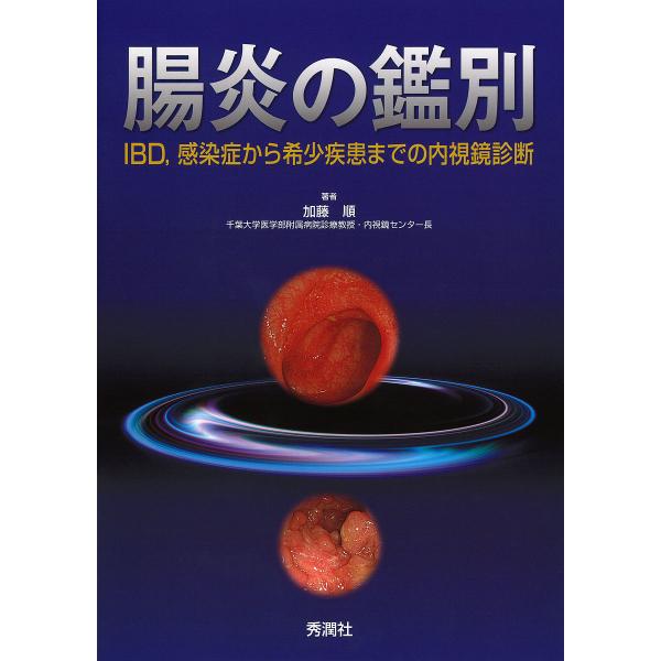 著:加藤順出版社:学研メディカル秀潤社発売日:2019年12月キーワード:腸炎の鑑別IBD，感染症から希少疾患までの内視鏡診断加藤順 ちようえんのかんべつあいびーでいーかんせんしようか チヨウエンノカンベツアイビーデイーカンセンシヨウカ か...
