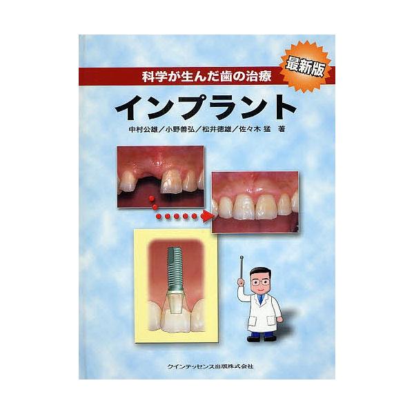 著:中村公雄　著:小野善弘　著:松井徳雄出版社:クインテッセンス出版発売日:2008年10月シリーズ名等:科学が生んだ歯の治療キーワード:科学が生んだ歯の治療インプラント中村公雄小野善弘松井徳雄 かがくがうんだはのちりよういんぷらんと カガ...