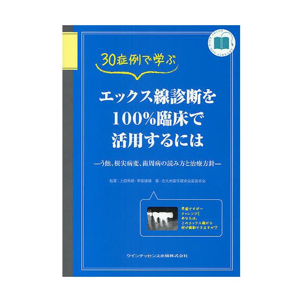 出版社:クインテッセンス出版発売日:2009年09月シリーズ名等:QUINT KICK−OFF LIBRARYキーワード:３０症例で学ぶエックス線診断を１００％臨床で活用するにはう蝕、根尖病変、歯周病の読み方と治療方針 さんじつしようれいで...