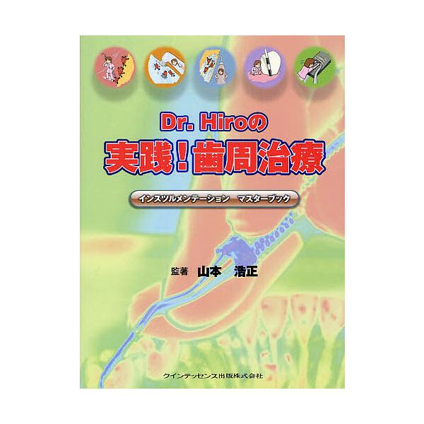 監:山本浩正　著:著足利奈々　著:熊本宏美出版社:クインテッセンス出版発売日:2012年05月キーワード:Dr．Hiroの実践！歯周治療インスツルメンテーションマスターブック山本浩正著足利奈々熊本宏美 どくたーひろのじつせんししゆうちりよう...
