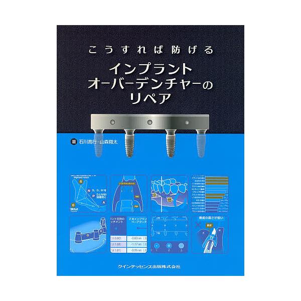 ※商品画像はイメージや仮デザインが含まれている場合があります。帯の有無など実際と異なる場合があります。著:石川高行　著:山森翔太出版社:クインテッセンス出版発売日:2013年10月キーワード:こうすれば防げるインプラントオーバーデンチャーの...