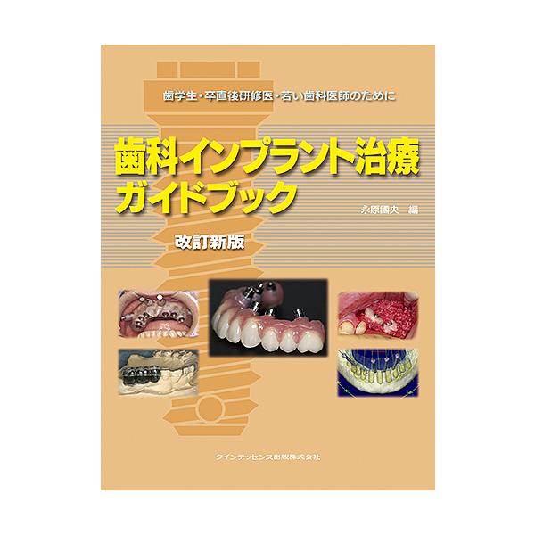 ※商品画像はイメージや仮デザインが含まれている場合があります。帯の有無など実際と異なる場合があります。編:永原國央出版社:クインテッセンス出版発売日:2015年12月キーワード:歯科インプラント治療ガイドブック歯学生・卒直後研修医・若い歯科...