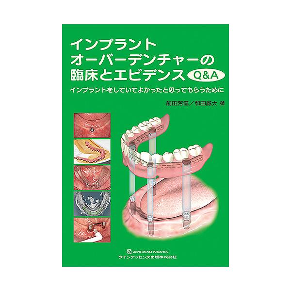 著:前田芳信　著:和田誠大出版社:クインテッセンス出版発売日:2017年03月キーワード:インプラントオーバーデンチャーの臨床とエビデンスQ＆Aインプラントをしていてよかったと思ってもらうために前田芳信和田誠大 いんぷらんとおーばーでんちや...