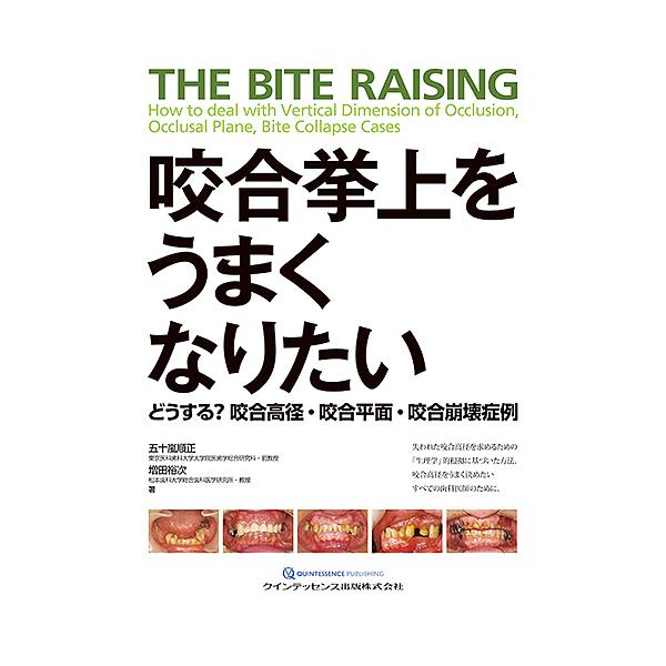 著:五十嵐順正　著:増田裕次出版社:クインテッセンス出版発売日:2017年04月キーワード:咬合挙上をうまくなりたいどうする？咬合高径・咬合平面・咬合崩壊症例五十嵐順正増田裕次 こうごうきよじようおうまくなりたいどうするこうごう コウゴウキ...