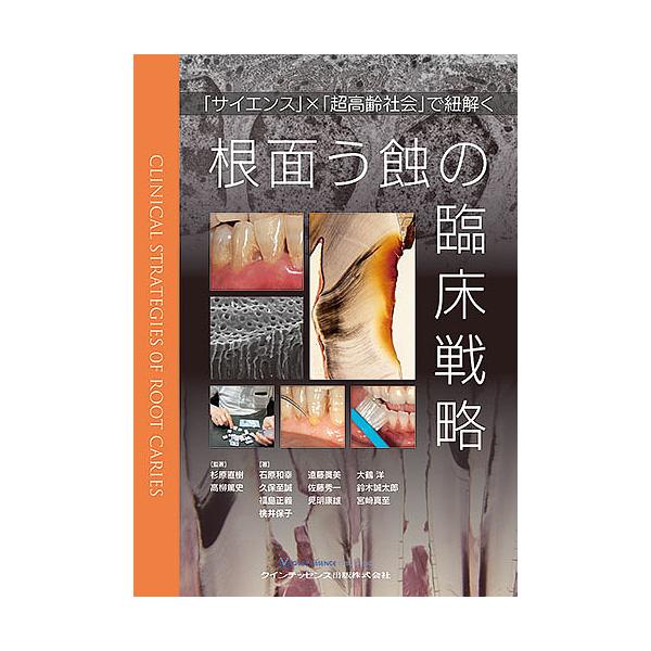 監:杉原直樹　監:著高柳篤史　著:著石原和幸出版社:クインテッセンス出版発売日:2018年05月キーワード:根面う蝕の臨床戦略「サイエンス」×「超高齢社会」で紐解く杉原直樹著高柳篤史著石原和幸 こんめんうしよくのりんしようせんりやくさいえん...