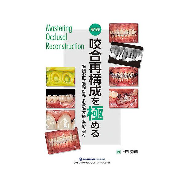 ※商品画像はイメージや仮デザインが含まれている場合があります。帯の有無など実際と異なる場合があります。著:上田秀朗出版社:クインテッセンス出版発売日:2018年07月キーワード:実践咬合再構成を極める歯列不正、歯周疾患、多数歯欠損を読み解く...
