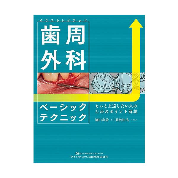 ※商品画像はイメージや仮デザインが含まれている場合があります。帯の有無など実際と異なる場合があります。著:樋口琢善　イラスト:佐竹田久出版社:クインテッセンス出版発売日:2018年10月キーワード:イラストレイテッド歯周外科ベーシックテクニ...