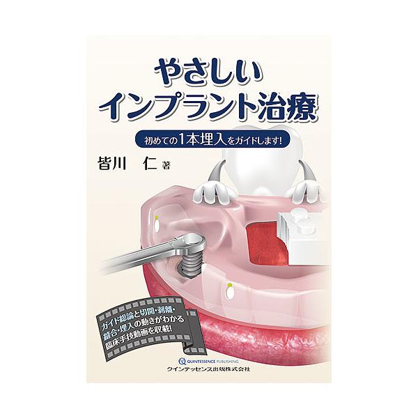 ※商品画像はイメージや仮デザインが含まれている場合があります。帯の有無など実際と異なる場合があります。著:皆川仁出版社:クインテッセンス出版発売日:2018年10月キーワード:やさしいインプラント治療初めての１本埋入をガイドします！皆川仁 ...