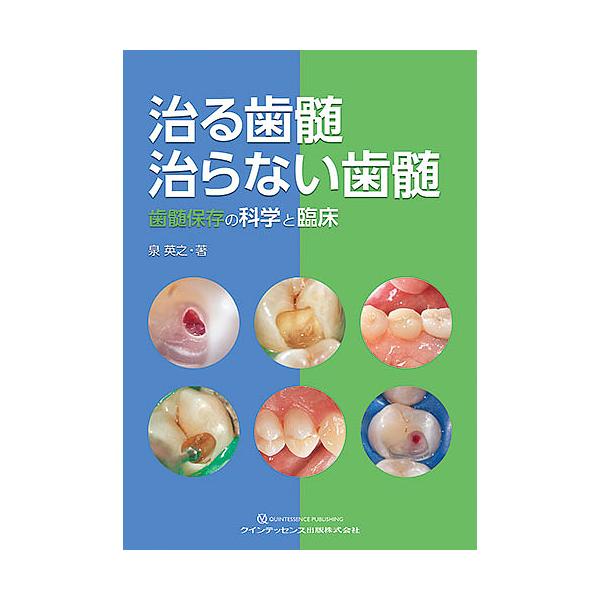 ※商品画像はイメージや仮デザインが含まれている場合があります。帯の有無など実際と異なる場合があります。著:泉英之出版社:クインテッセンス出版発売日:2018年10月キーワード:治る歯髄治らない歯髄歯髄保存の科学と臨床泉英之 なおるしずいなお...