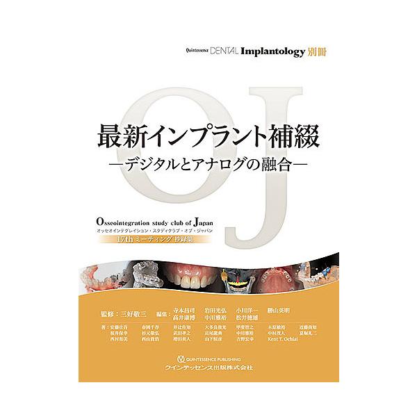 監修:三好敬三　編集:寺本昌司　編集:岩田光弘出版社:クインテッセンス出版発売日:2019年02月シリーズ名等:Quintessence DENTAL Implantology別冊 オッセオインテグレイション・スタディクラブ・オブ・ジャパン...