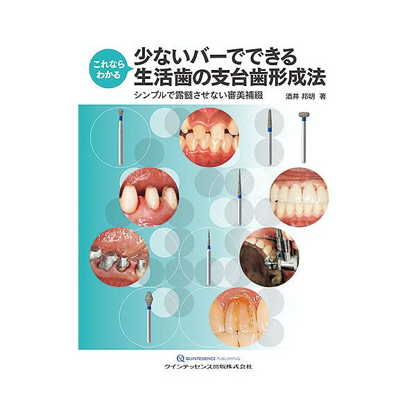 ※商品画像はイメージや仮デザインが含まれている場合があります。帯の有無など実際と異なる場合があります。著:酒井邦明出版社:クインテッセンス出版発売日:2019年03月キーワード:これならわかる少ないバーでできる生活歯の支台歯形成法シンプルで...