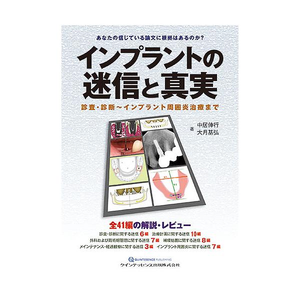 ※商品画像はイメージや仮デザインが含まれている場合があります。帯の有無など実際と異なる場合があります。著:中居伸行　著:大月基弘出版社:クインテッセンス出版発売日:2019年06月キーワード:インプラントの迷信と真実診査・診断〜インプラント...