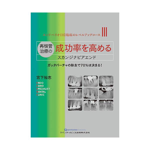 著:宮下裕志出版社:クインテッセンス出版発売日:2019年11月シリーズ名等:エンド・ペリオ日常臨床のレベルアップコース ３キーワード:再根管治療の成功率を高めるスカンジナビアエンドガッタパーチャの除去で７０％は決まる！宮下裕志 さいこんか...