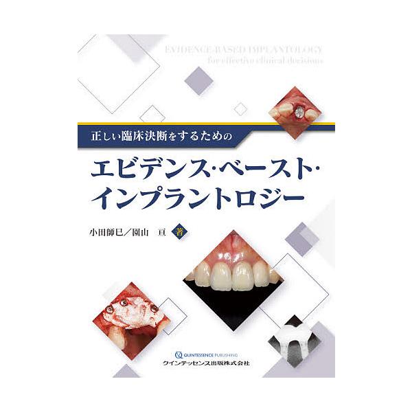 ※商品画像はイメージや仮デザインが含まれている場合があります。帯の有無など実際と異なる場合があります。著:小田師巳　著:園山亘出版社:クインテッセンス出版発売日:2020年08月キーワード:正しい臨床決断をするためのエビデンス・ベースト・イ...