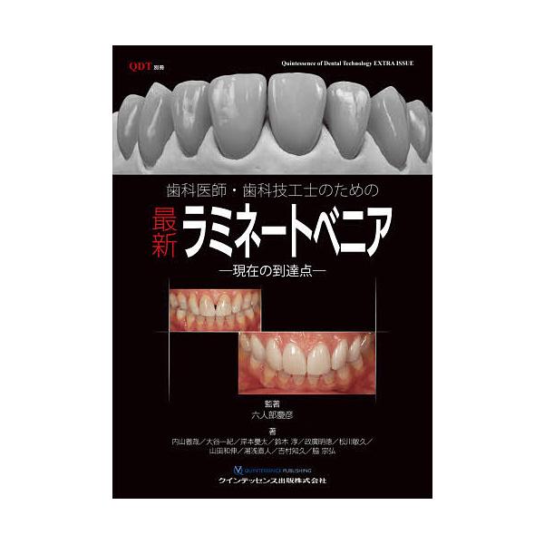 ※商品画像はイメージや仮デザインが含まれている場合があります。帯の有無など実際と異なる場合があります。監:六人部慶彦　著:著内山徹哉　著:大谷一紀出版社:クインテッセンス出版発売日:2020年10月キーワード:歯科医師・歯科技工士のための最...