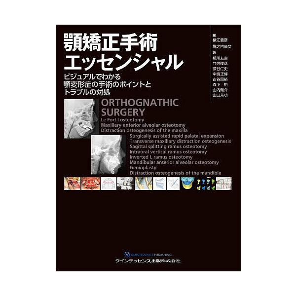 ※商品画像はイメージや仮デザインが含まれている場合があります。帯の有無など実際と異なる場合があります。編:横江義彦　編:堀之内康文　著:相川友直出版社:クインテッセンス出版発売日:2021年04月キーワード:顎矯正手術エッセンシャルビジュア...