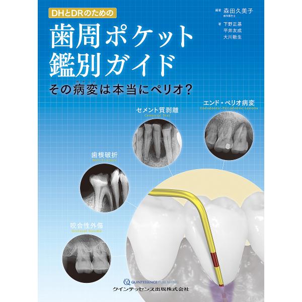 ※商品画像はイメージや仮デザインが含まれている場合があります。帯の有無など実際と異なる場合があります。編著:森田久美子　著:下野正基　著:平井友成出版社:クインテッセンス出版発売日:2022年01月キーワード:DHとDRのための歯周ポケット...